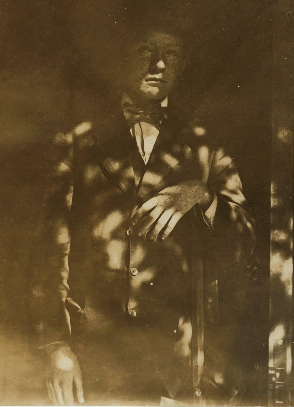 Photographs document life of a child amputee of Pennsylvania’s ...